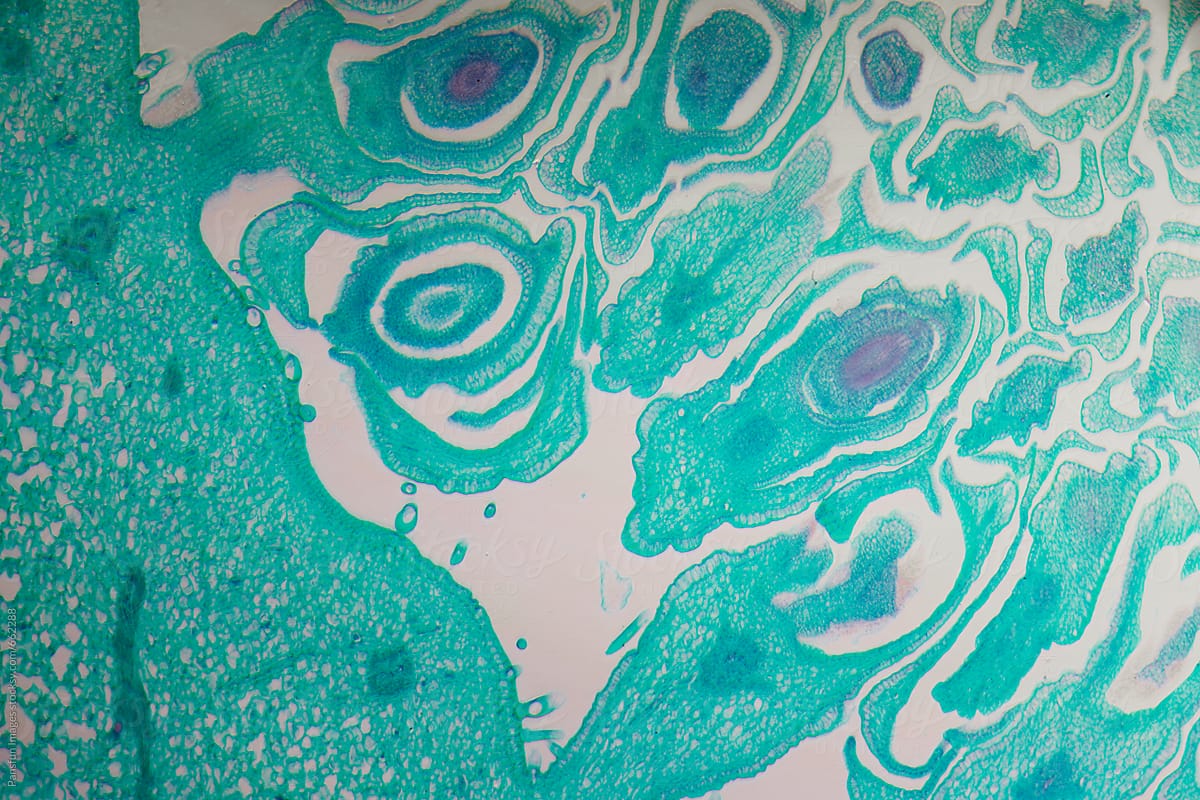 "Plant Cells Of Fruit C.s. Micrograph" by Stocksy Contributor "Pansfun ...