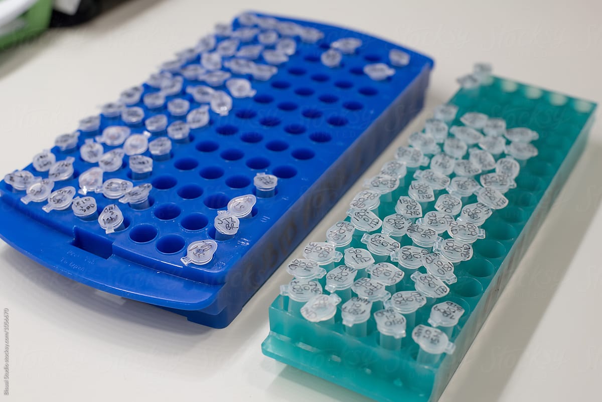 "Multy Well Tray In A Laboratory" by Stocksy Contributor "Bisual Studio ...
