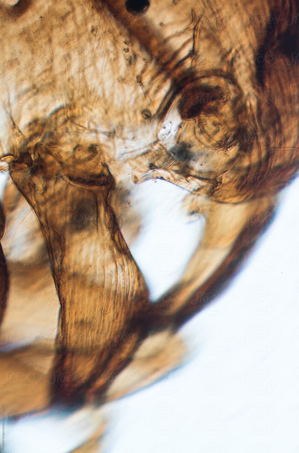 "Insect Ant Jaw, Light Micrograph" by Stocksy Contributor "Pansfun ...