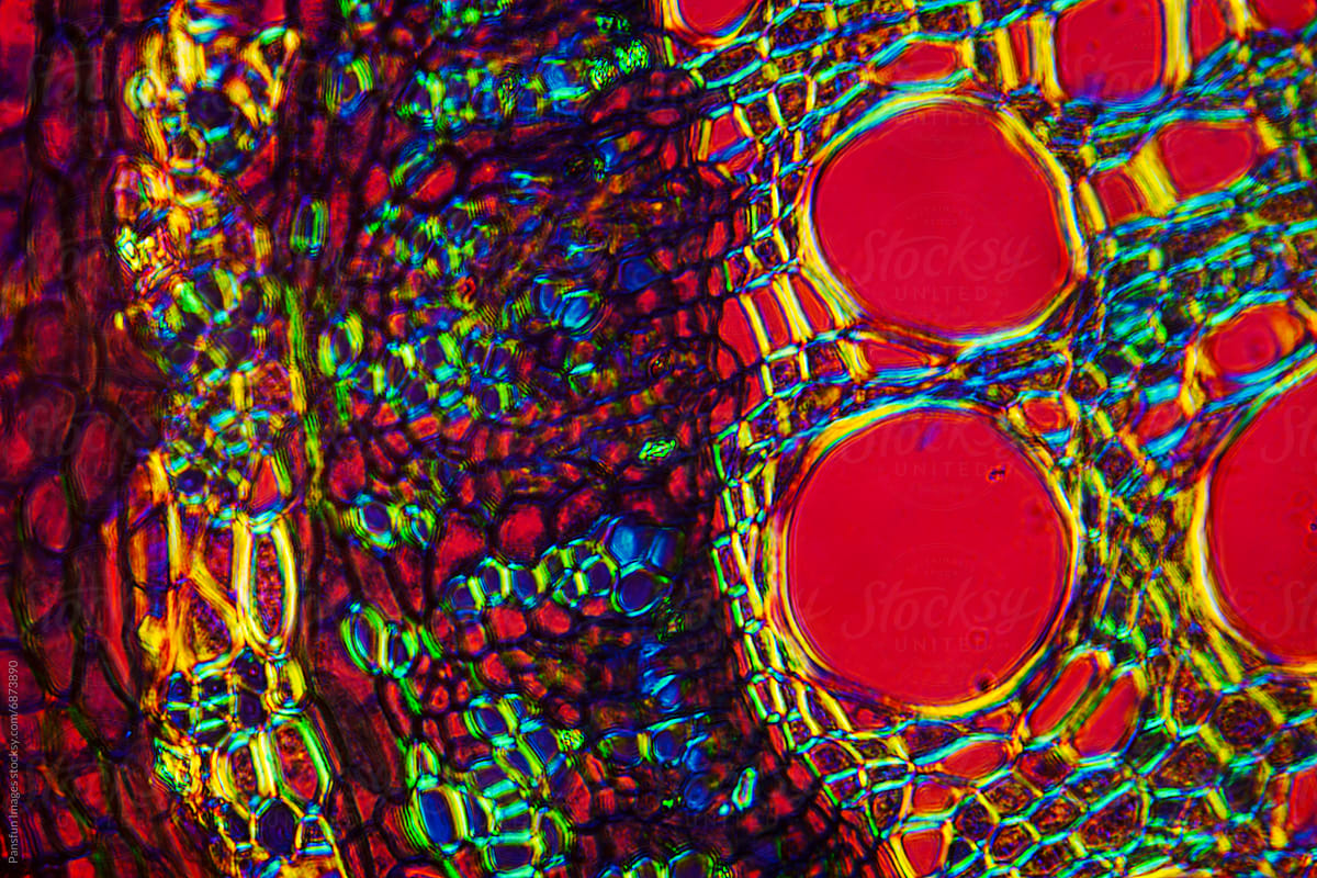 "Micrograph Of Herba Abrus Plant Cells" by Stocksy Contributor "Pansfun ...