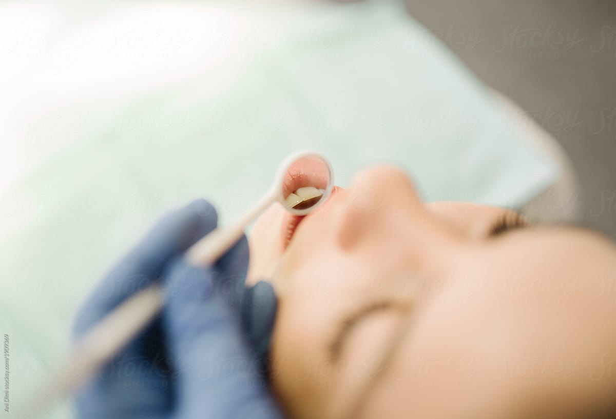 "Close Up Of Teeth At Dentist Ordination" by Stocksy Contributor "Ani ...