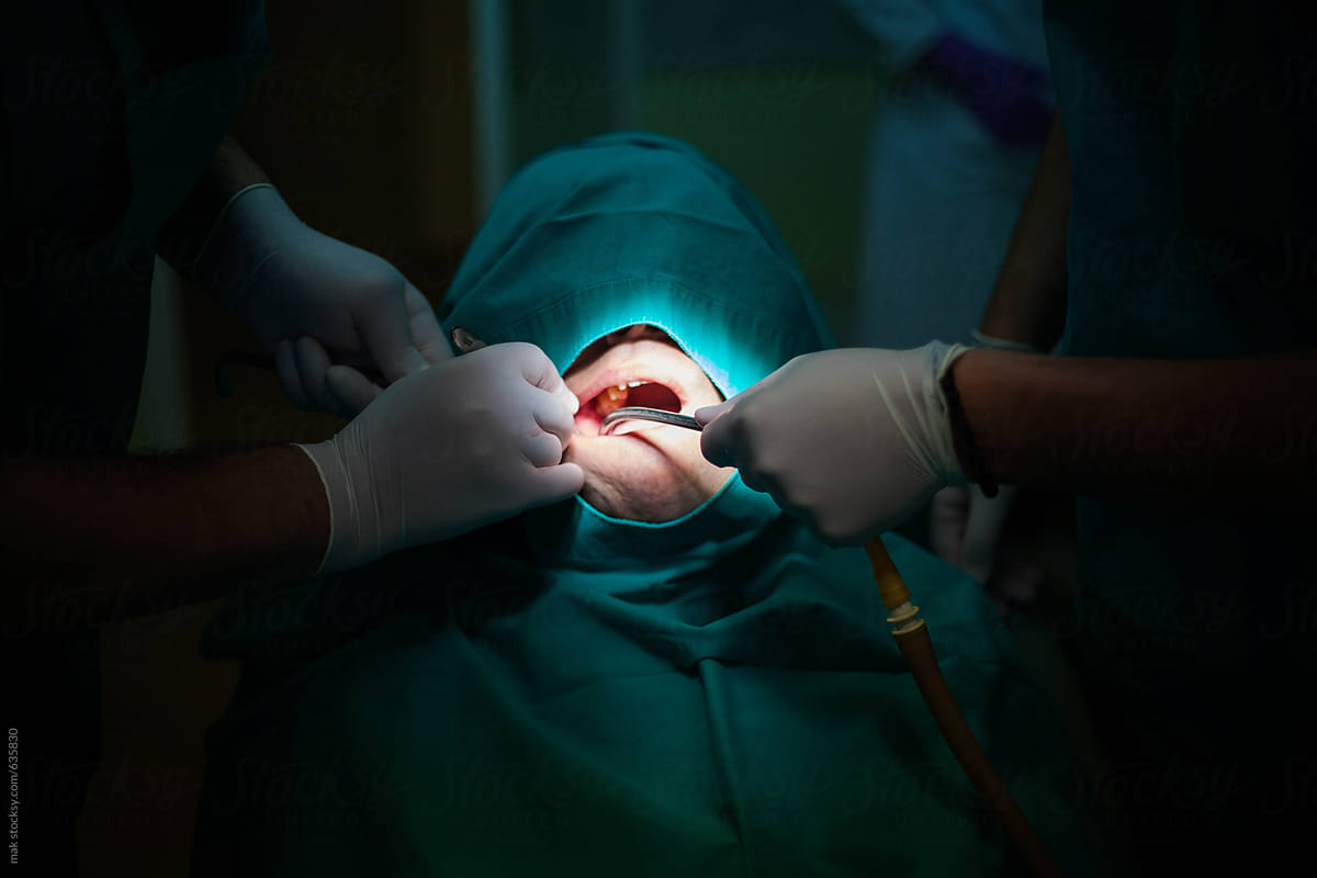 "Doctor Hands Operating On A Man's Teeth" by Stocksy Contributor ...