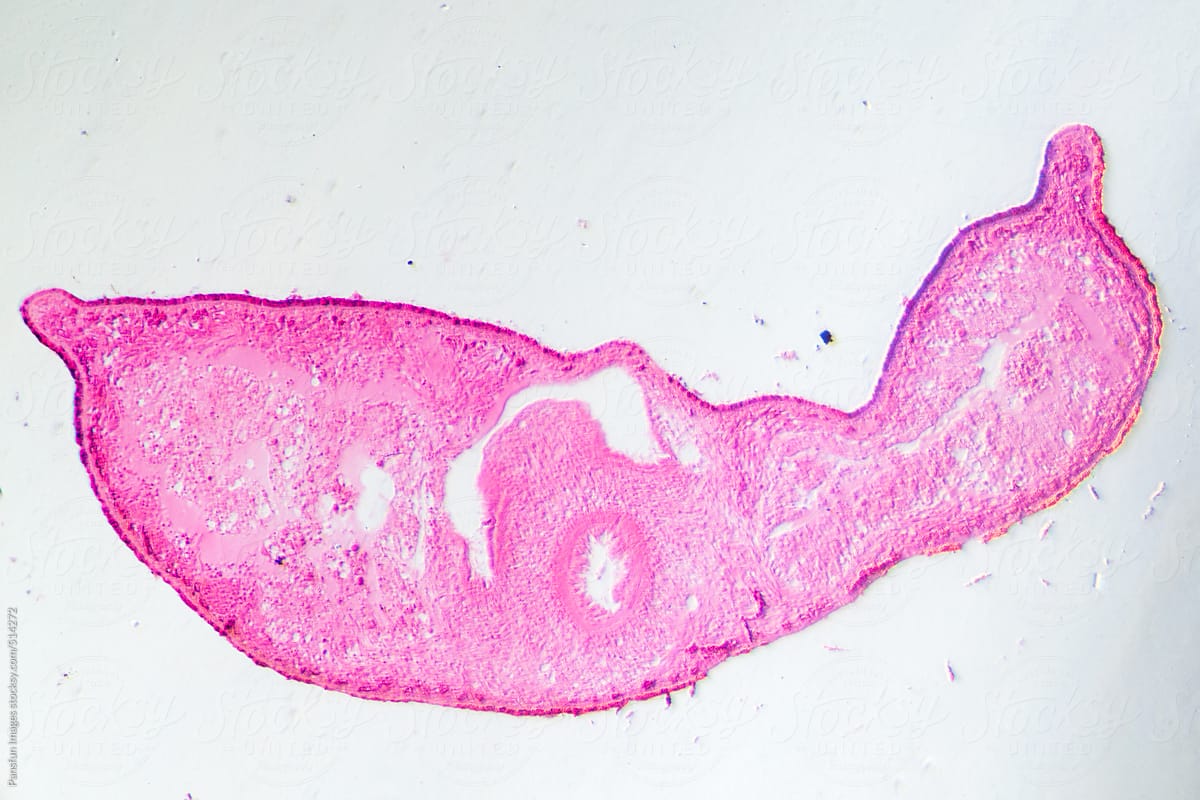 "Planaria Flatworm" by Stocksy Contributor "Pansfun Images" - Stocksy