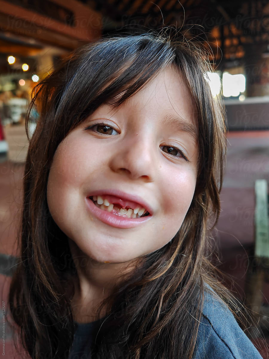 "Little Girl Showing Loose Baby Tooth. POV UGC" by Stocksy Contributor ...
