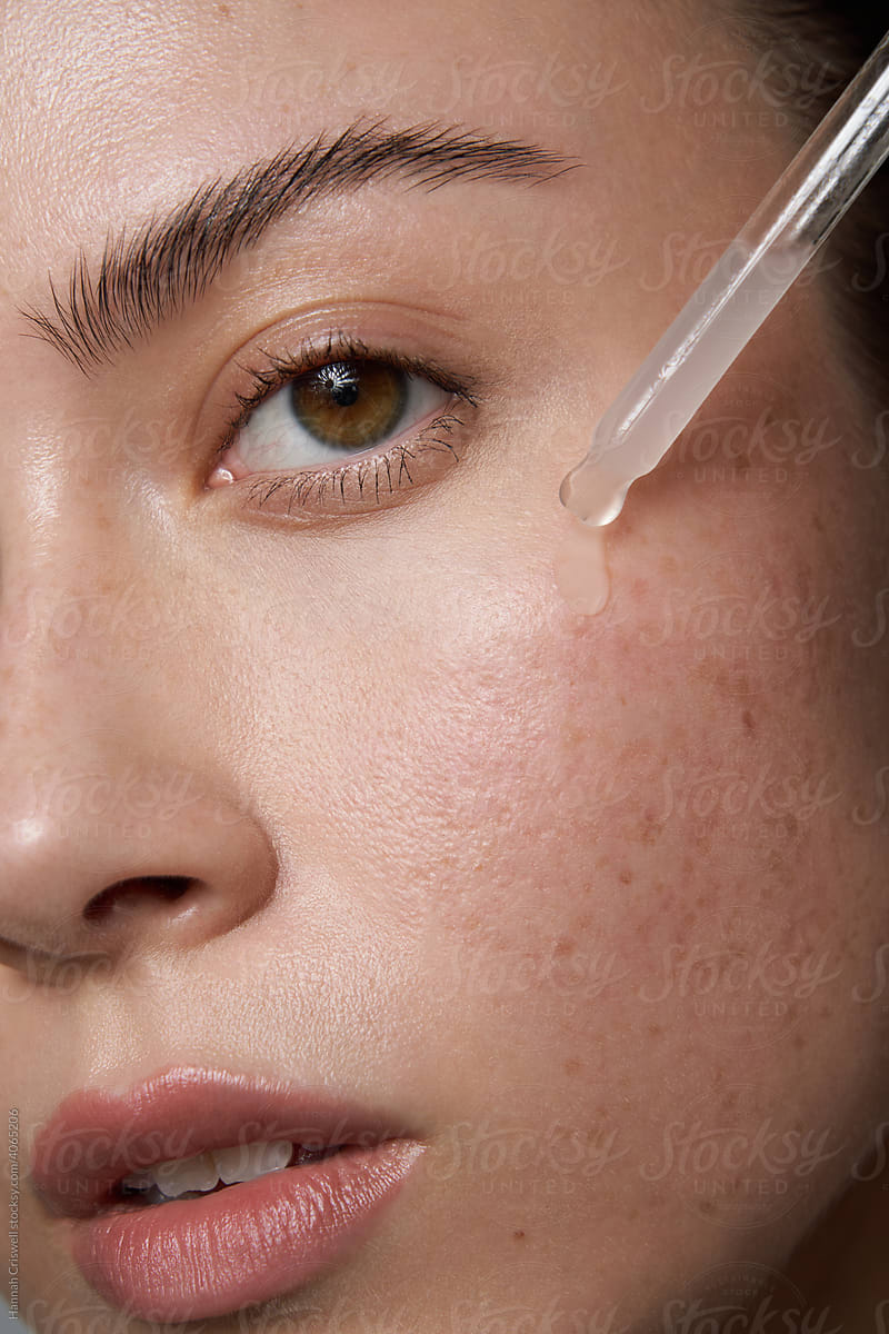 "Face Serum Dripping Onto Freckled Woman's Face" by Stocksy Contributor ...