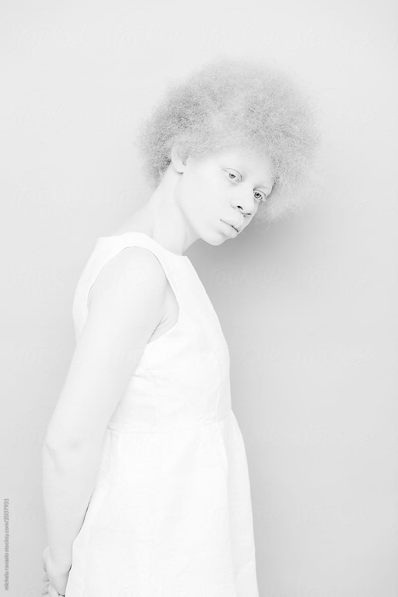 "Portrait Of Albino Young Woman" by Stocksy Contributor "Michela ...