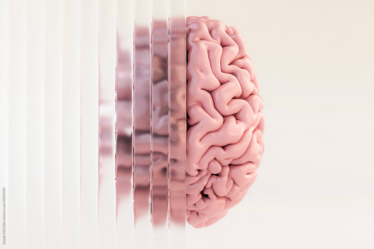 "3D Brain Distortion From Anxiety Concept" by Stocksy Contributor ...